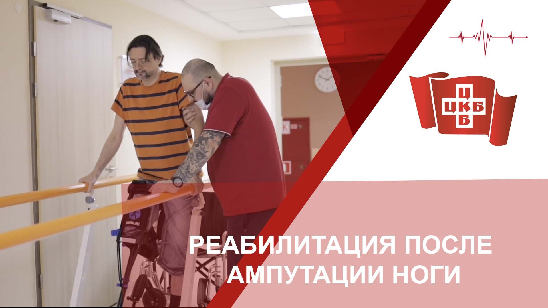 Реабилитация после ампутации ноги