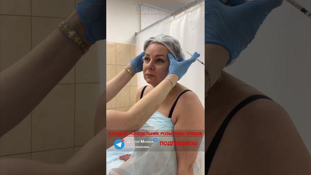 Сделали процедуру контурной пластики  #shorts