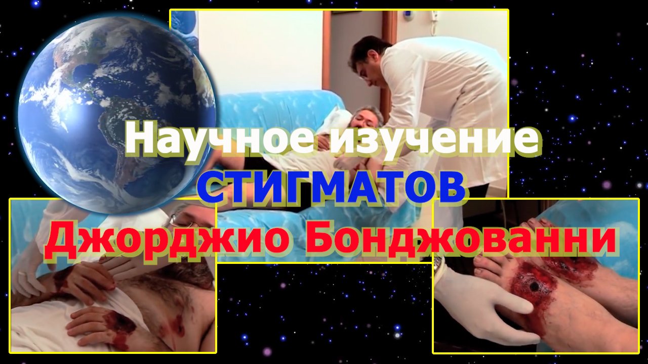 Научное изучение стигматов Джорджио Бонджованни