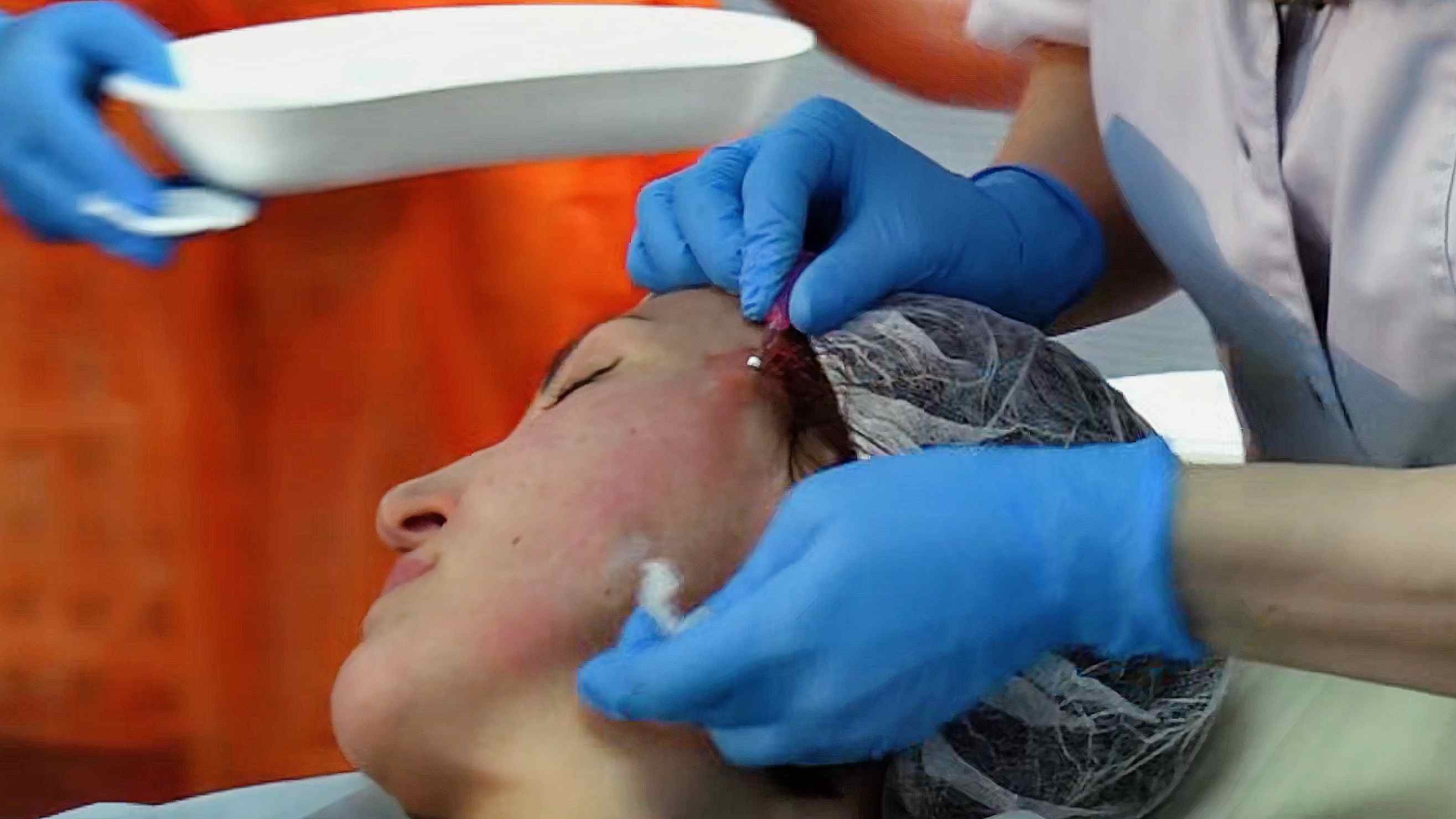 Подтяжка лица. Мастер-класс