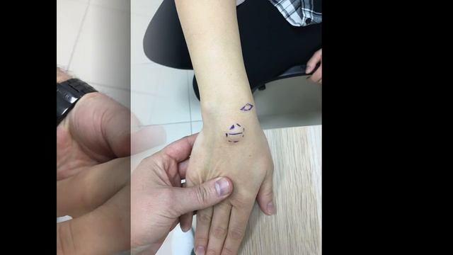 Удаление гигромы кисти в Уфе