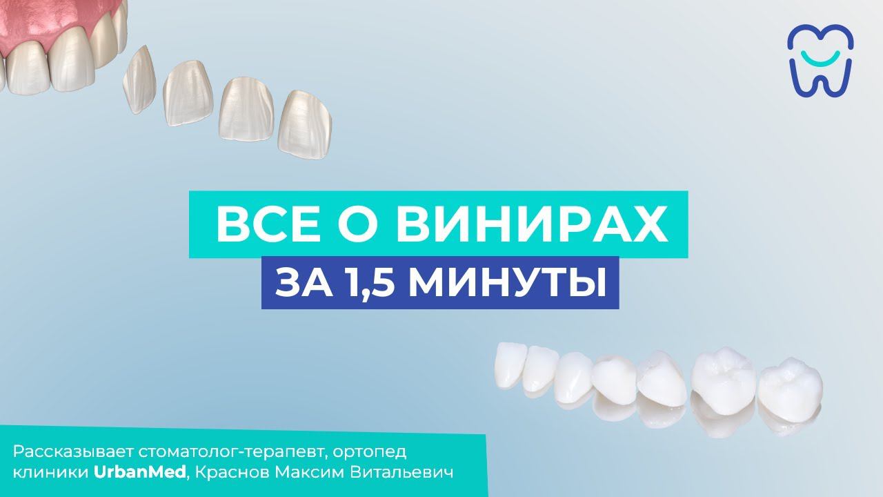 Всё о винирах за 1,5 минуты.
