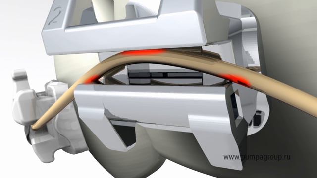 QuicKlear — паз брекета