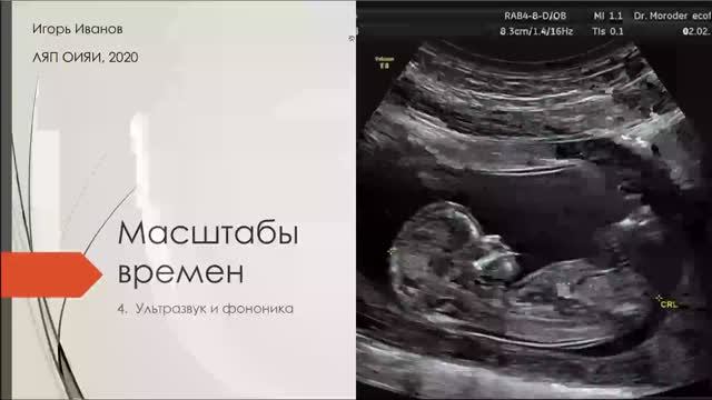 И.Иванов Лекция 4. "Ультразвук и фононика" / I.Ivanov Lecture 4. "Ultrasound and phononics"
