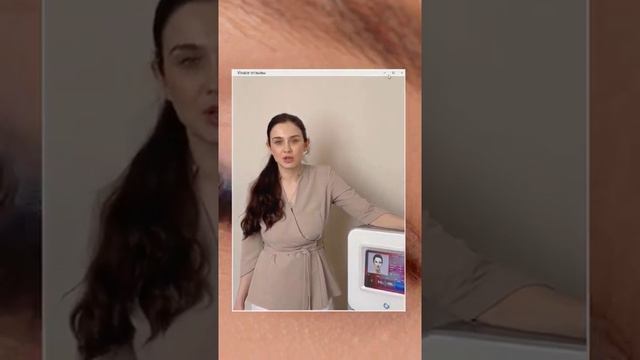 ОТЗЫВ об аппарате VIVACE доктора Хаченковой Елены, клиника Белая Аллея, Архангельск