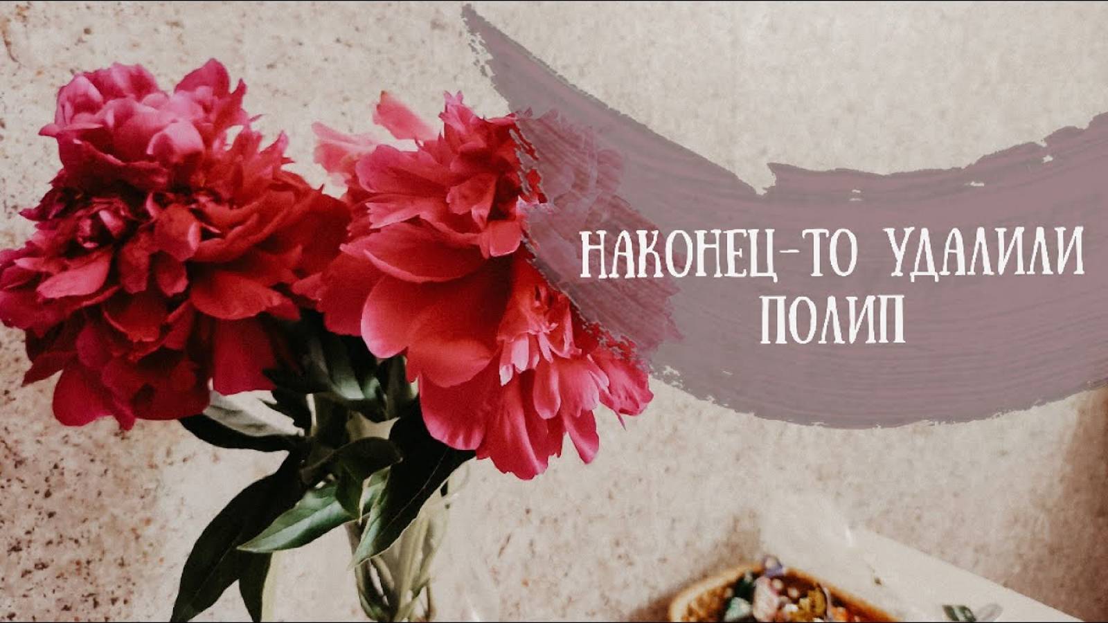 Как прошла операция I Есть ли жизнь без подгузников