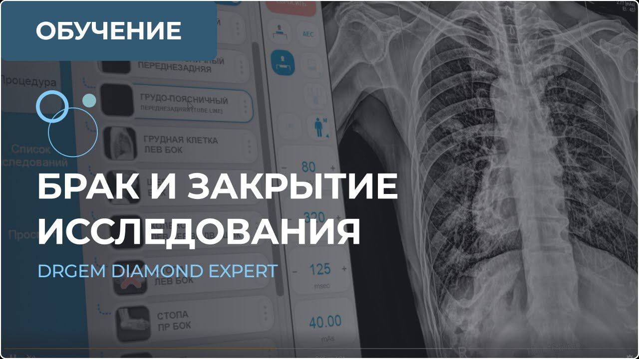 Брак и закрытие исследования. Рентегн-аппарат DRGEM DIAMOND. Программное обеспечение RADMAX. Часть 3