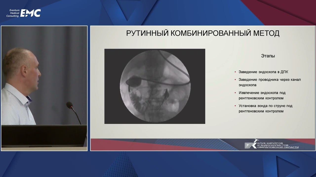 14 Современные методики эндоскопической декомпрессии при тонкокишечной непроходимости - Нечаев А.В.