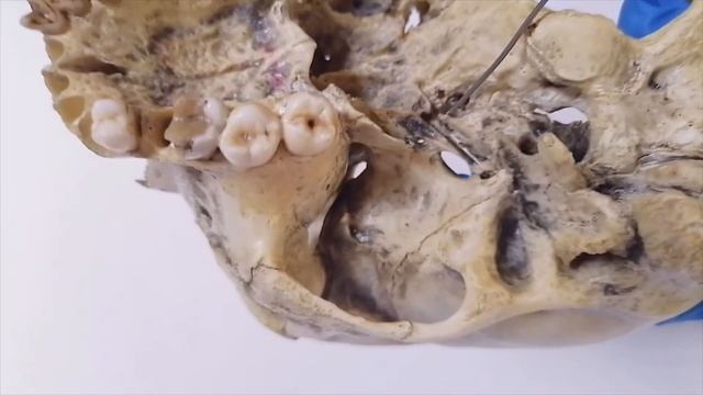 Череп в целом