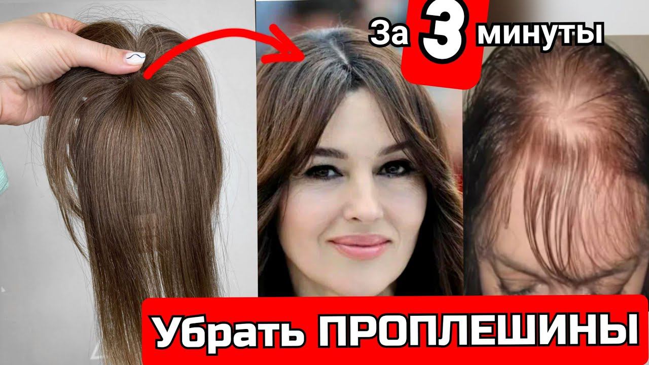 Как скрыть алопецию ? Накладка из волос на сетке теменная, инструкции от парикмахера #алопеция