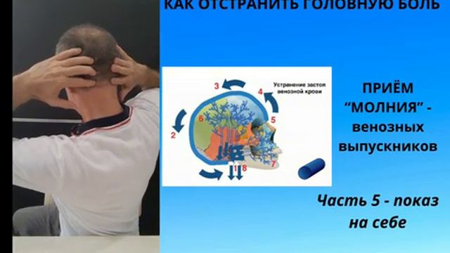 КАК УСТРАНИТЬ ГОЛОВНУЮ БОЛЬ. РАСКРЫТИЕ ЦЕНТРАЛЬНОГО ВЕНОЗНОГО КАНАЛА. ПРИЁМ "МОЛНИЯ". Часть 5.