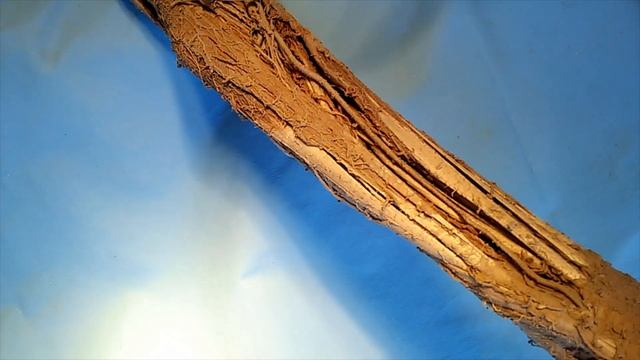 Длинные ветви плечевого сплетения Сосуды плеча и предплечья