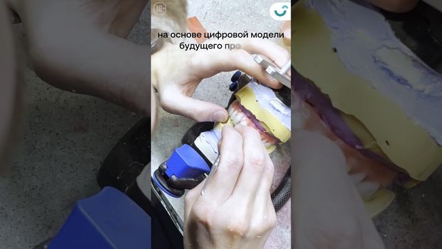 Зубы из воска?! Зачем нужны при создании протезов на импланты