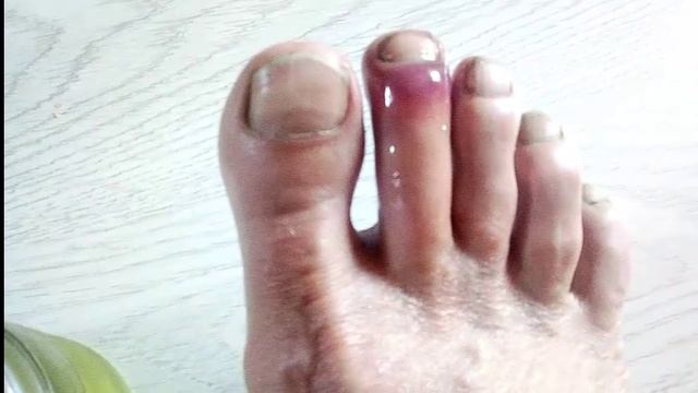 Озонированные масла. Обезболивание и восстановление тканей..mp4