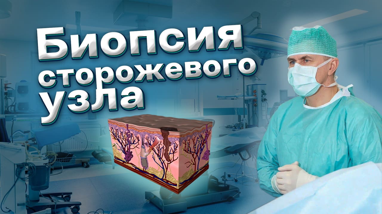 Биопсия сторожевого лимфоузла при меланоме в Санкт-Петербурге