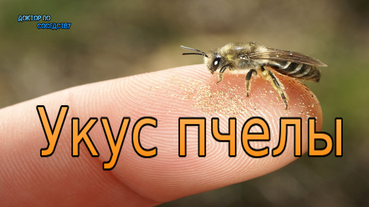 Укус пчелы. Доктор по соседству.