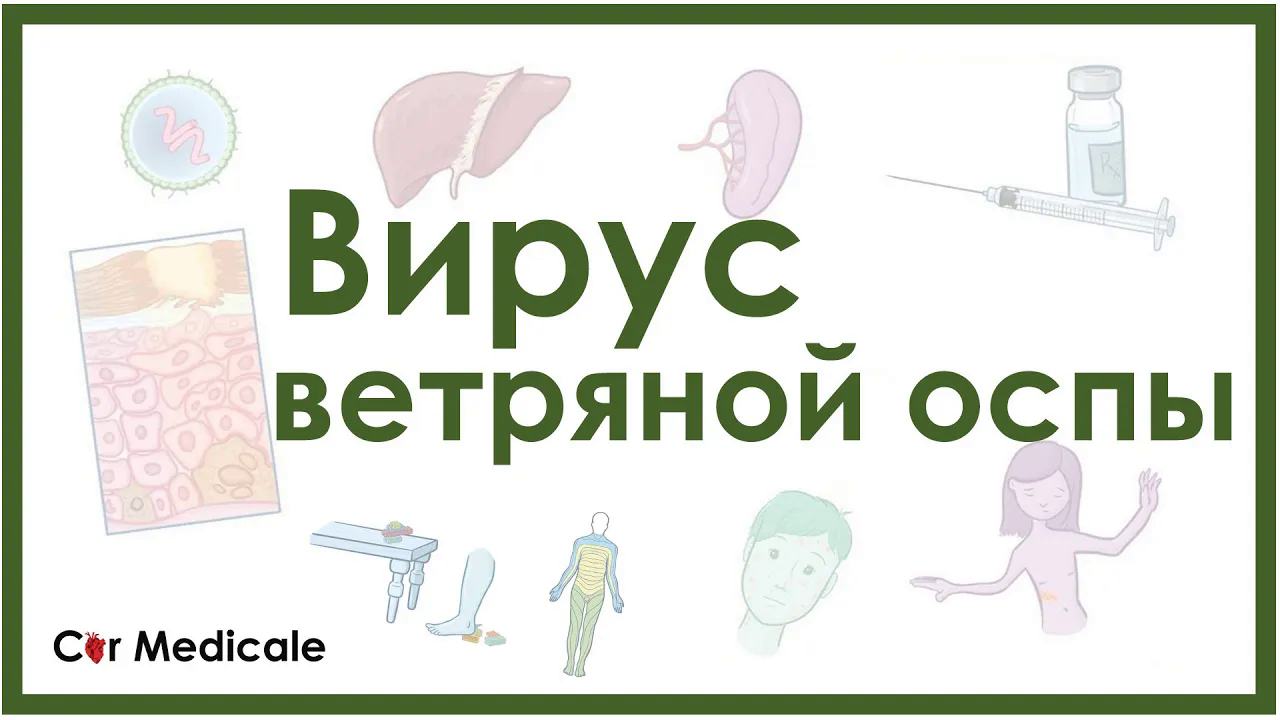 Вирус ветряной оспы (ветрянка и опоясывающий лишай) - клиника, диагностика, лечение