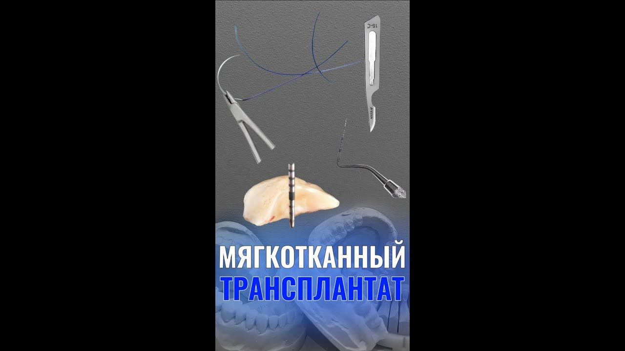 Из какой зоны получать мягкотканный трансплантат ?