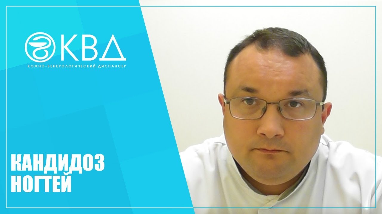 1412  Кандидоз ногтей