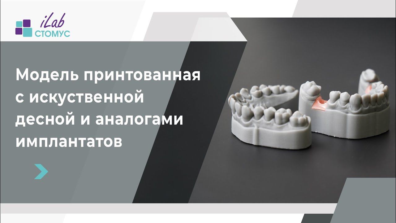 Модель принтованная с искусственной десной