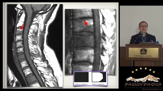 Лучевая диагностика спинальной патологии. Клинические случаи