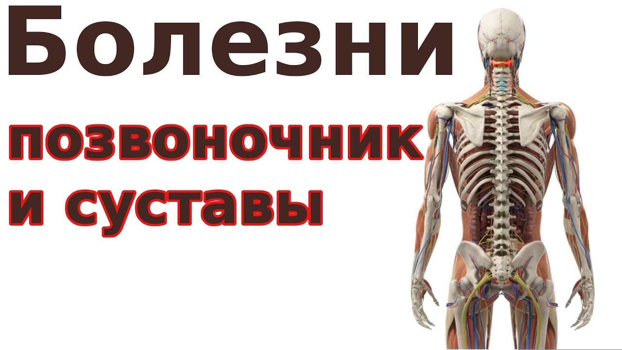 ? Болезни позвоночника и суставов - общая концепция