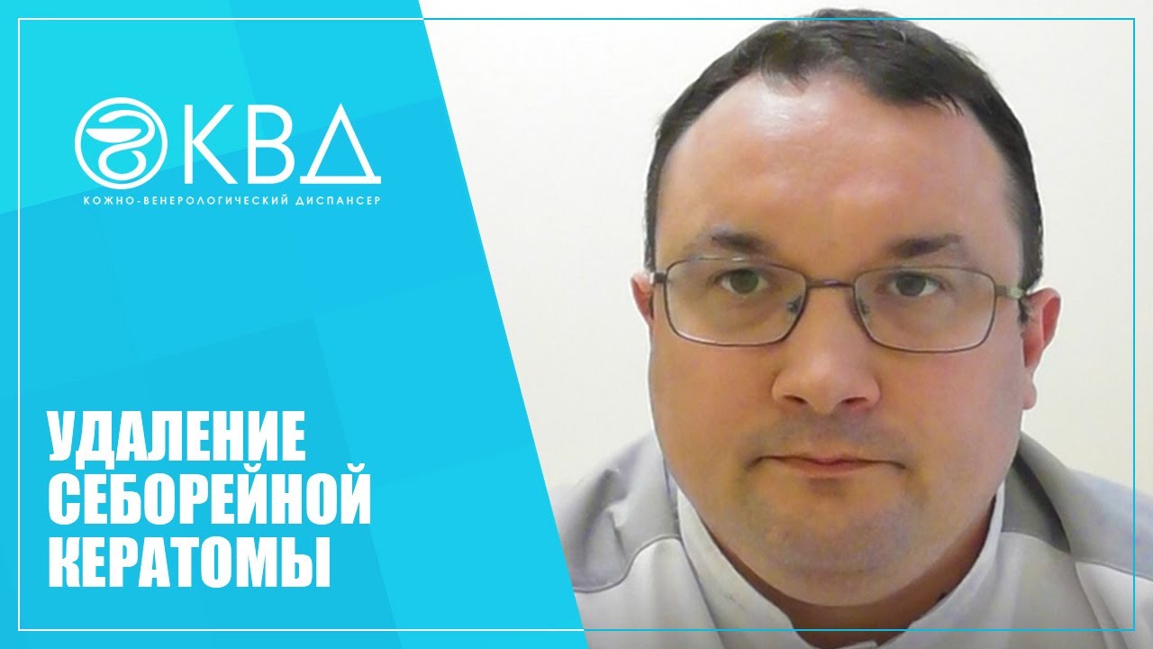 1184  Удаление себорейной кератомы