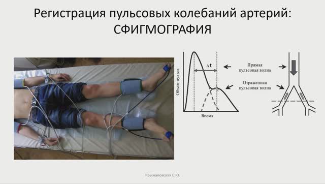 Тонус сосудов