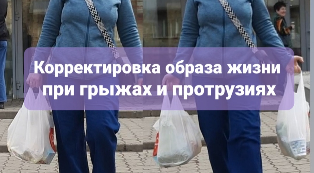 Корректировка образа жизни при грыжах и протрузиях