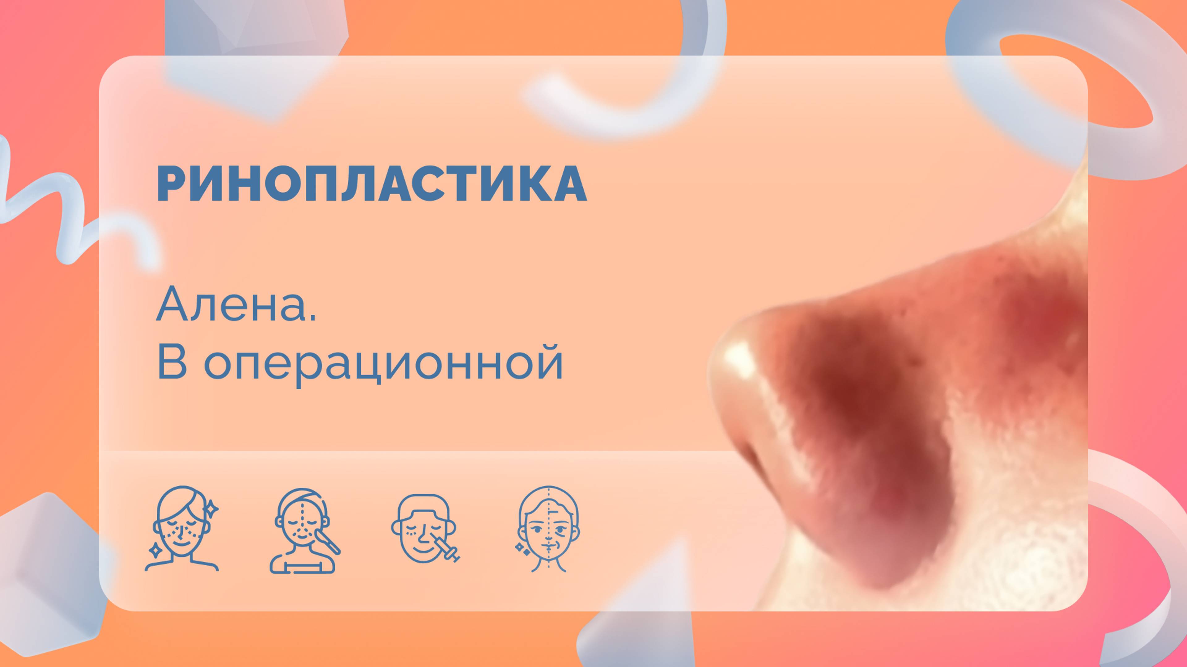 Алена. Ринопластика. В операционной