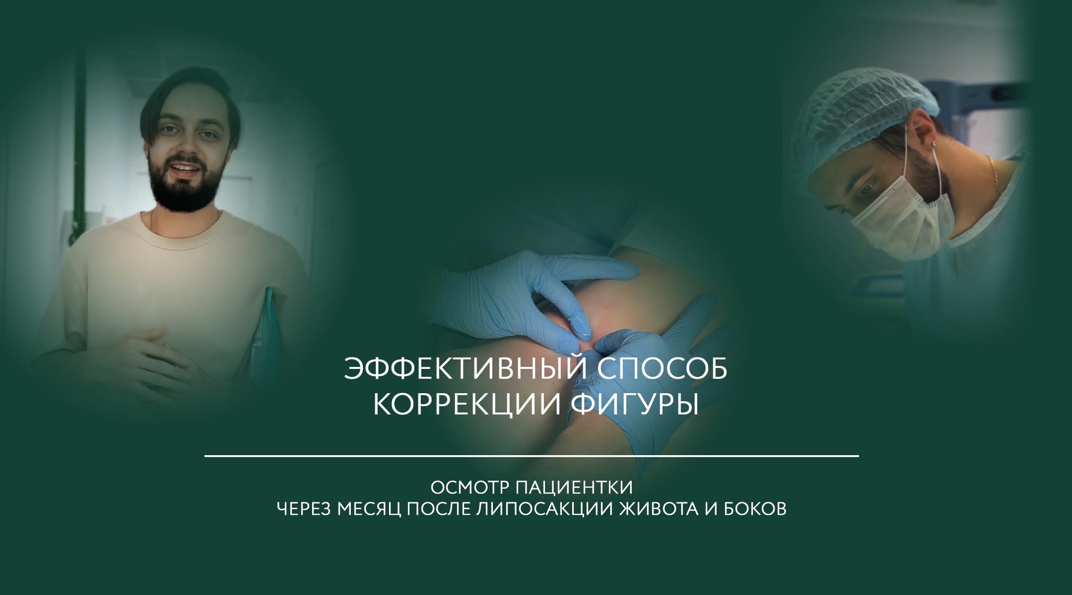 Удаление подкожной жировой клетчатки области живота и боков