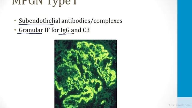Почки USMLE - 4. Заболевания нефрона - 4.Мембранопролиферативный гломерулонефрит (Boards and Beyond)