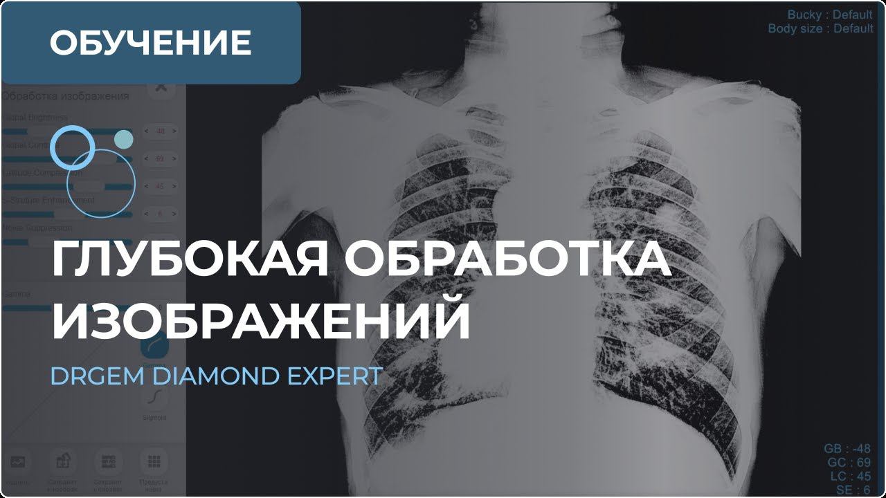 Улучшение визуализации с помощью глубокой обработки изображений. Рентген DRGEM DIAMOND. Часть 5