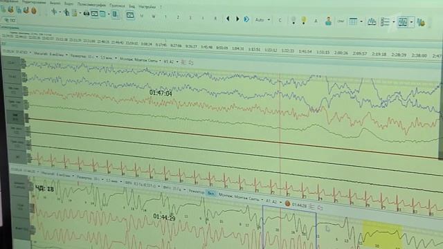 Вред мобильных телефонов для здоровья человека