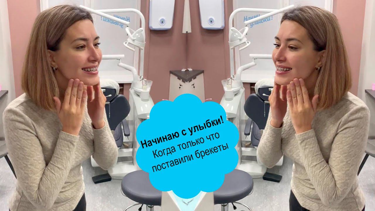 Когда только что поставили брекеты!