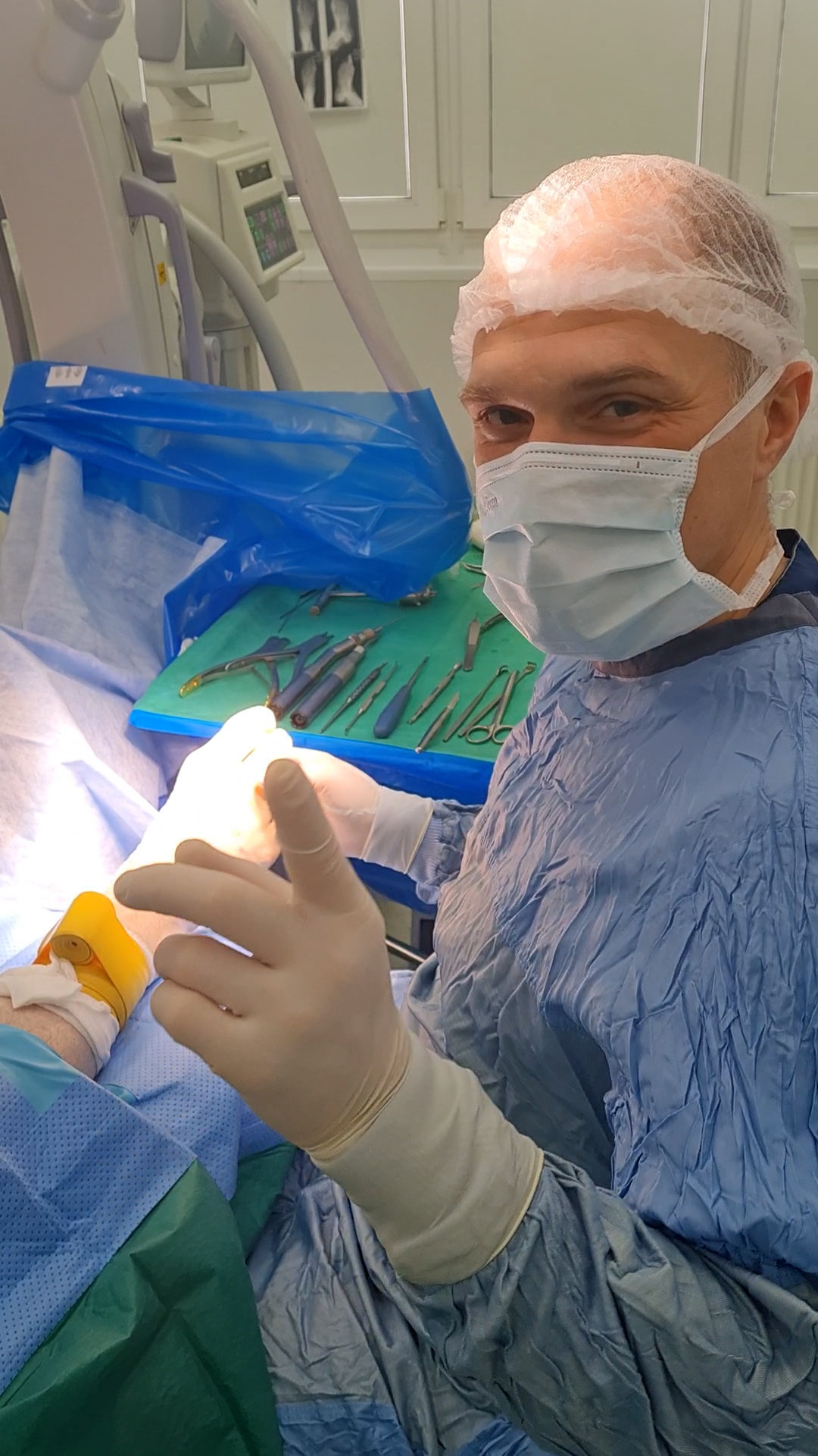 Убираем шишку на стопе. Малоинвазивный TBL-метод