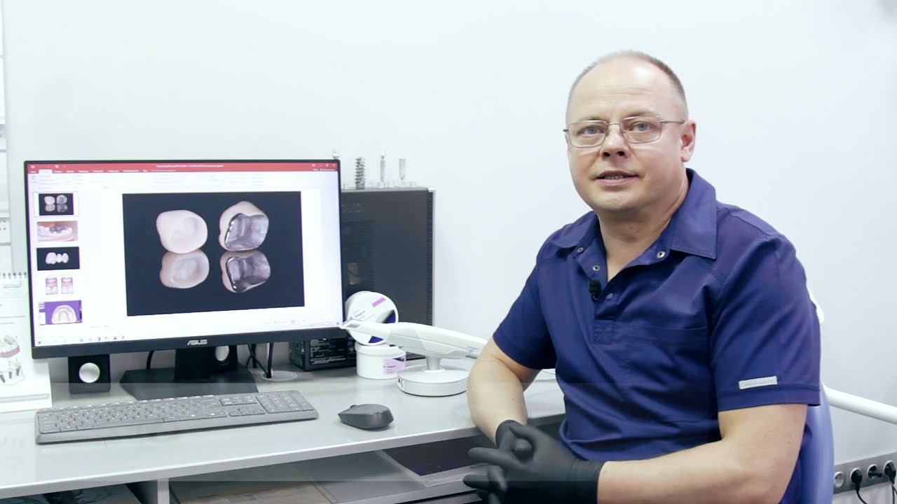 Металлокерамика и безметалловые коронки. Плюсы и минусы