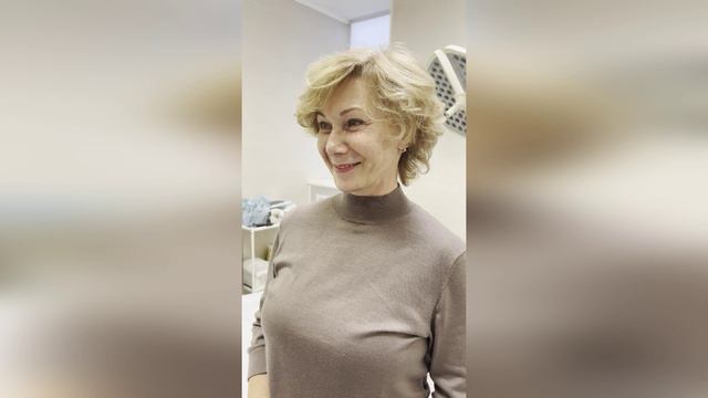 Три месяца после фейслифтинга, эндоскопического лифтинга лба и круговой блефаропластики с миопексией