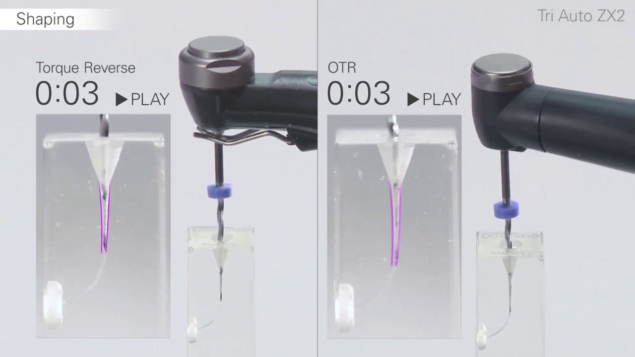 TriAuto ZX2 - Сравнение функции Реверсивного крутящего момента и OTR