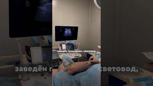 Операция Лазерное лечение варикозного расширения вен ног.  Флеболог Лепшоков Мурат Кималович