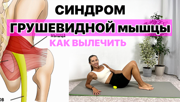 Синдром грушевидной мышцы - Упражнения - лучшее лечение. Тренировка для дома