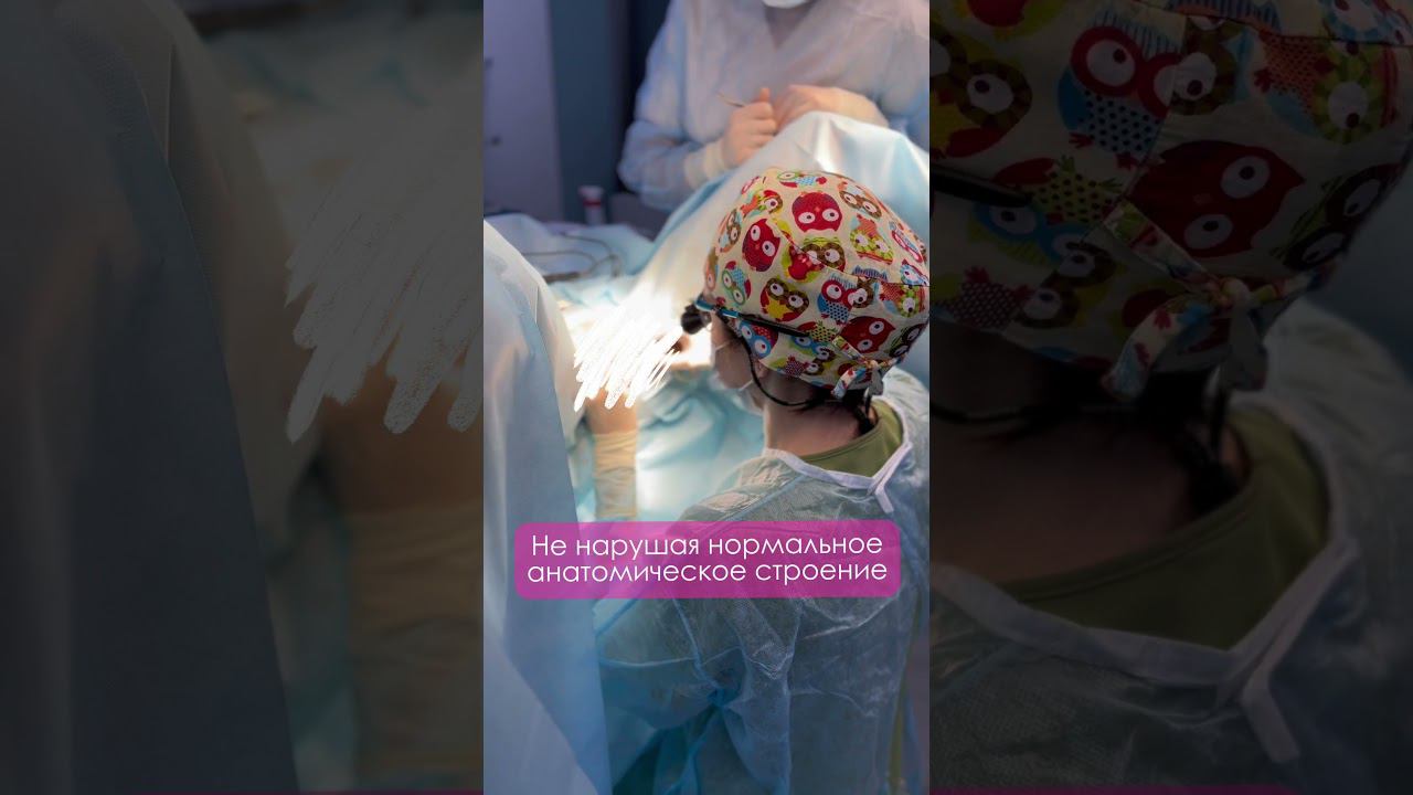 ЛАБИОПЛАСТИКА: ВАЖНОЕ УСЛОВИЕ при выполнении! #лабиопластика #shorts #пластическийхирург