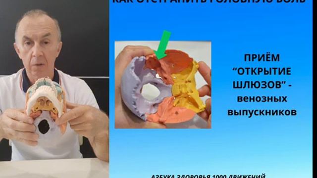 КАК УСТРАНИТЬ ГОЛОВНУЮ БОЛЬ. ПРИЁМ "ОТКРЫТИЕ ШЛЮЗОВ - ВЕНОЗНЫХ ВЫПУСКНИКОВ". Часть 1.