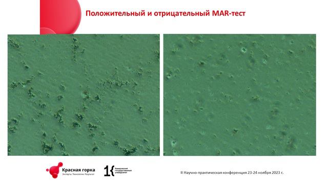 008 ЛЕСНИКОВ АНТОН Иммунологический фактор мужского бесплодия в Кузбассе