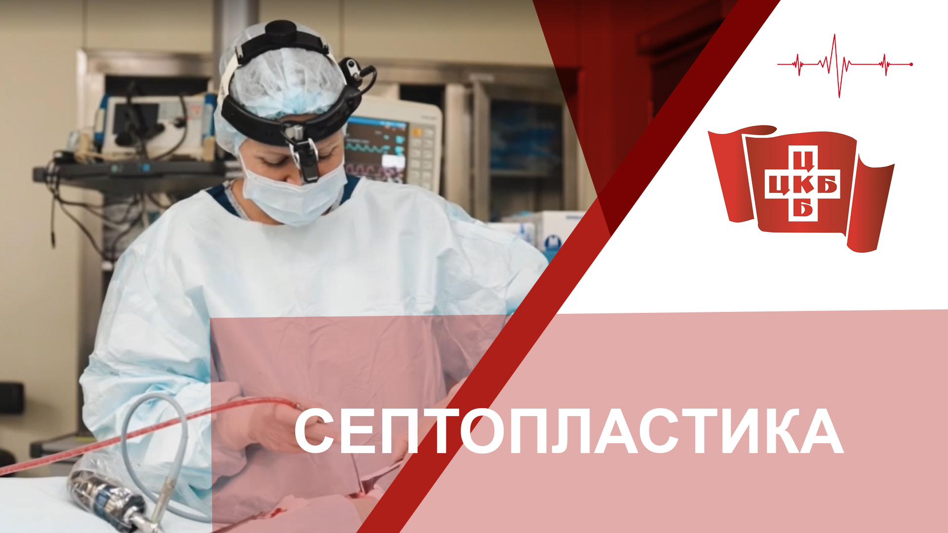 Септопластика