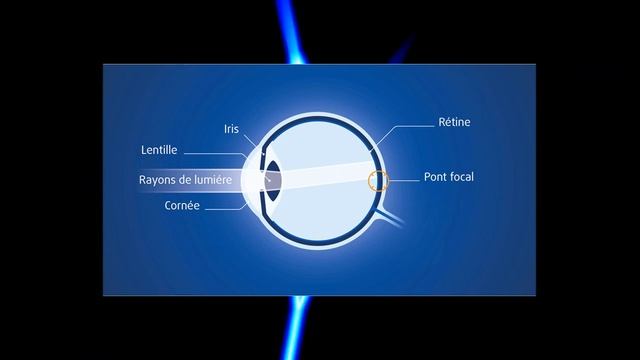Почему у тебя такое идеальное зрение? l тихий саблиминал l Mila