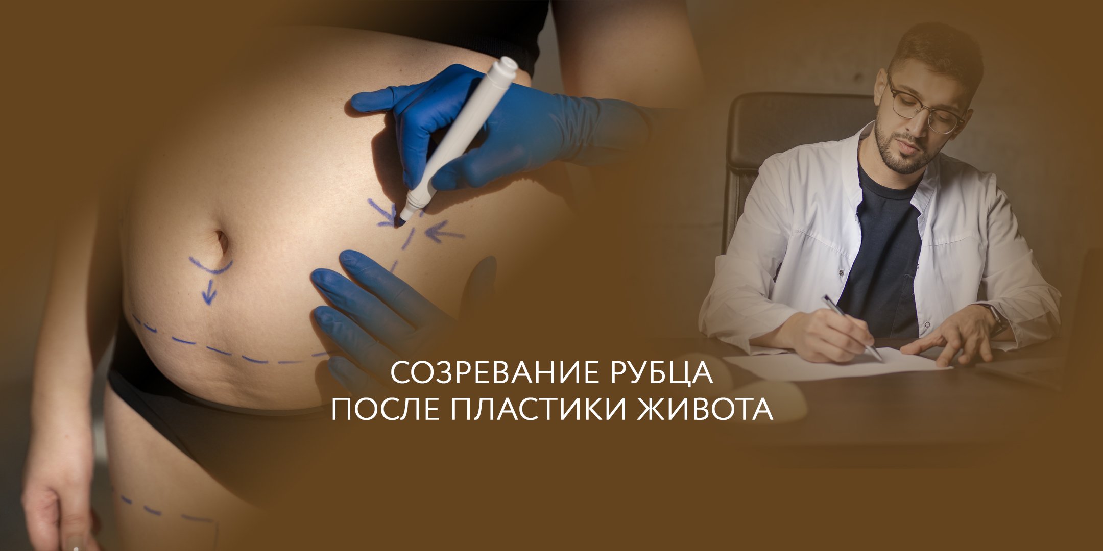 Абдоминопластика // Как созревает рубец // Шов после пластики живота