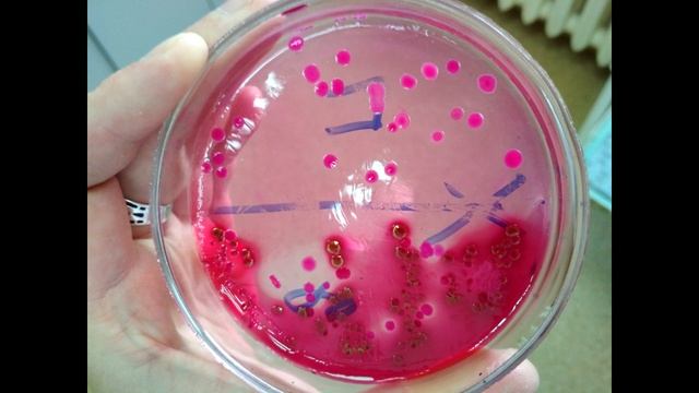 Практикум по микробиологии. Среды. Посев. Оценка колоний. Дисковая проба