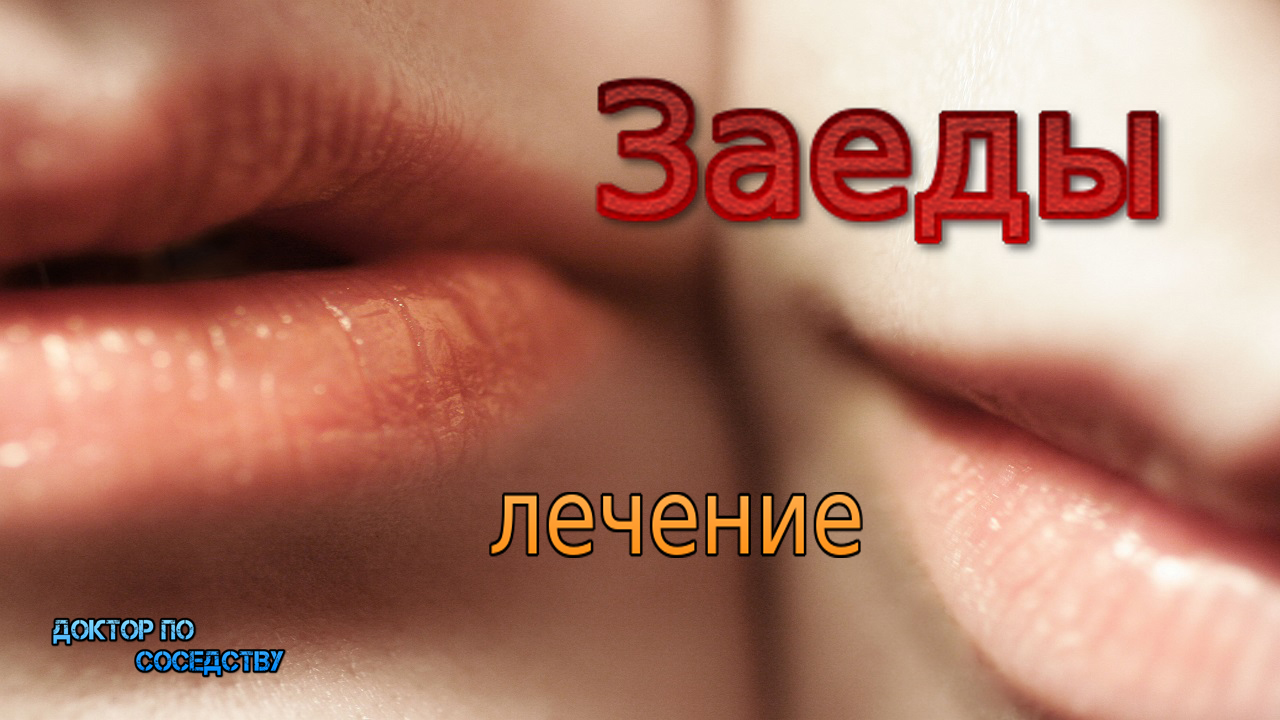 Лечение заед. Доктор по соседству.