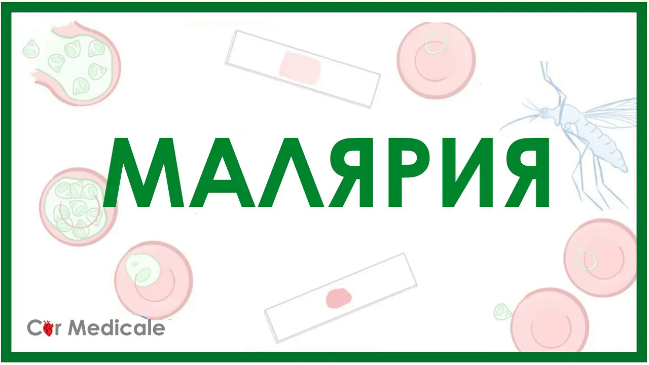 Малярия - малярийный плазмодий, виды, механизм развития, симптомы,